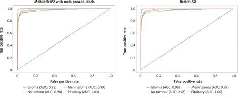 Figure 4 From Brain Tumour Detection From Magnetic Resonance Imaging