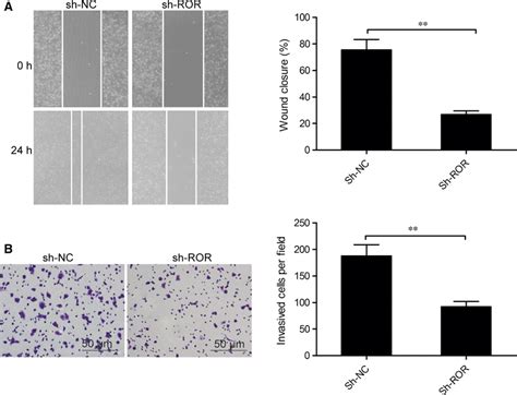 Knockdown Of Regulator Of Reprogramming Ror Inhibited Osteosarcoma Download Scientific