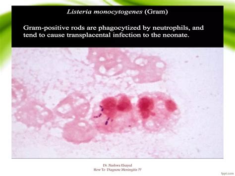 How To Diagnose Meningitis In The Lab Pptx