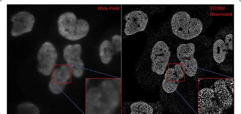 Comparison Between Conventional Wide Field Fluorescence Microscopy Download Scientific Diagram
