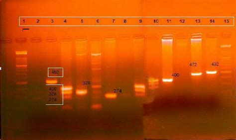 An Example Of Y Chromosome Microdeletion Analysis Download Scientific Diagram