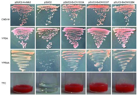 Localization Of Three Bxcn Legumain Transcripts In The Nematode By In Download Scientific