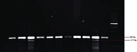 C677t Mutation Analysis Download Scientific Diagram