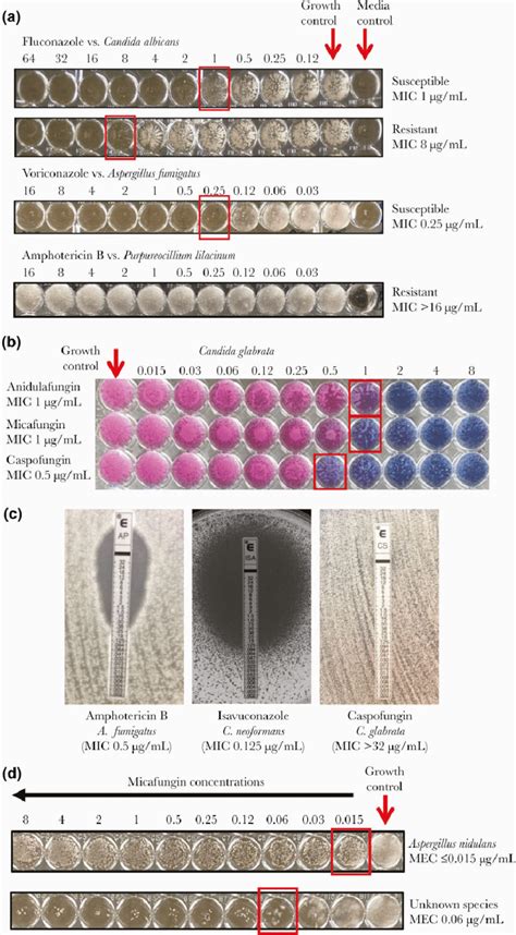 Examples Of Antifungal Susceptibility Testing Examples Of Various Download Scientific Diagram