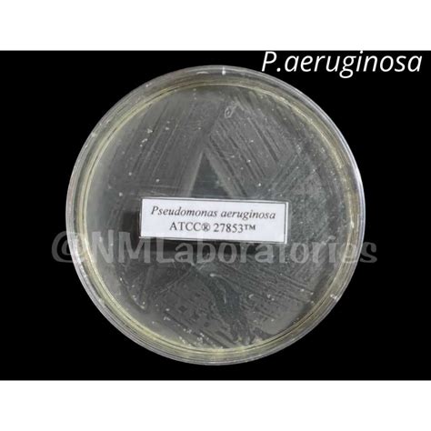 Jual Kultur Bakteri Pseudomonas Aeruginosa Atcc® 27853 Siap Pakai Shopee Indonesia