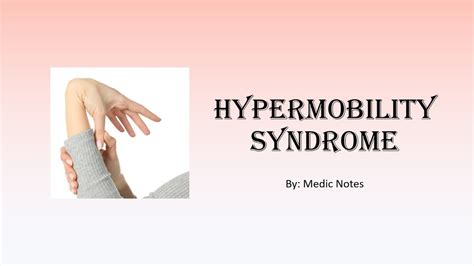 Symptoms Of Joint Hypermobility Syndrome At Armand Dunn Blog