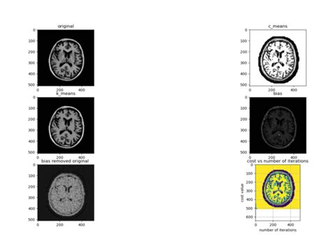 Github Albinjmneurocluster An Advanced Image Segmentation Toolkit