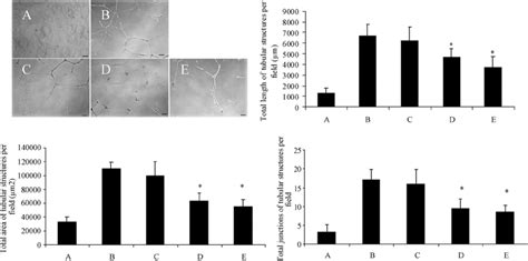 Runx2 Silencing In Chondrosarcoma Cells Reduces Huvec Tubulogenesis In