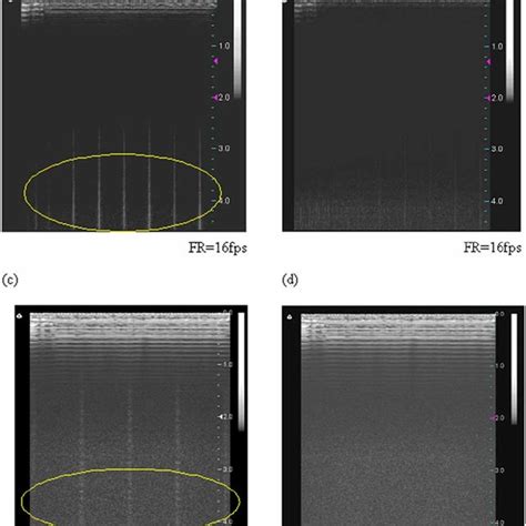 US Images With Probe At Isocenter Of 3 T MRI System While MRI Is Download Scientific Diagram