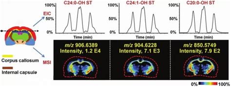 Unlocking Precision In Spatial Metabolomics Essential Detection Parameters For Cutting Edge