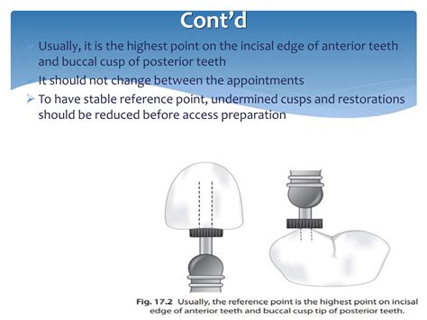 Working Length Determination In Endodontics 2 Pptx