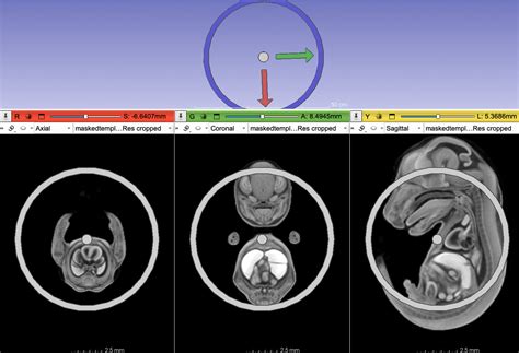 Resampling A Linear Transformation Support 3d Slicer Community