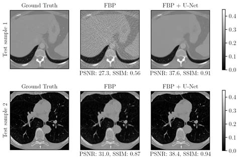 Deep Learning And Inverse Problems Universität Bremen