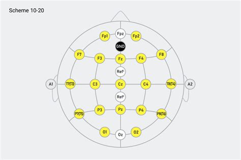 10 20 Système Délectrodes En électroencéphalographie Eeg Gvb Gelimed Gmbh 10 20 Système Délectrodes En électroencéphalographie Eeg Gvb Gelimed Gmbh