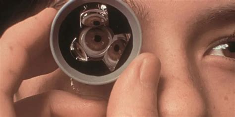 What Is Gonioscopy American Academy Of Ophthalmology What Is Gonioscopy American Academy Of Ophthalmology