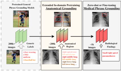 논문 리뷰 Anatomical grounding pre training for medical phrase grounding