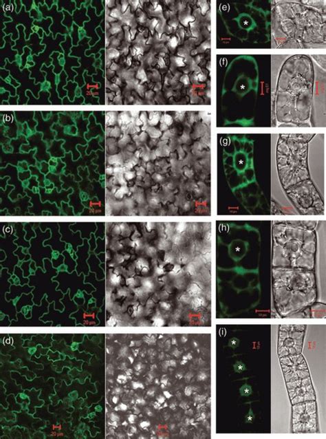 Subcellular Localization Of Yfp Fused Atnap1 Proteins Leaf Epidermal Download Scientific