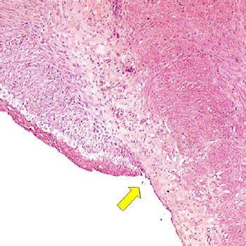 SM Of Deep Tubular Structures Of The Appendix Testis HE Original Download Scientific Diagram