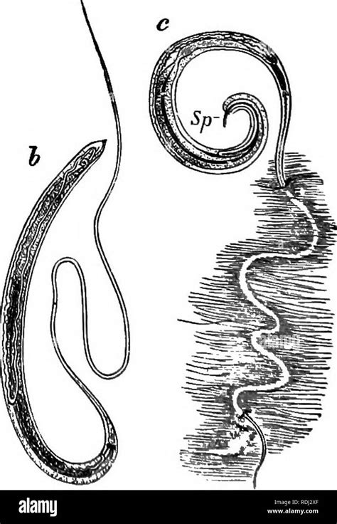 Trichinella Spiralis Labeled