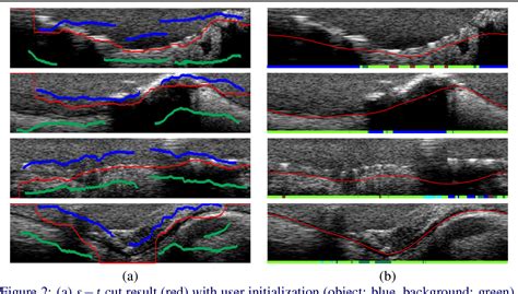 Figure 2 From Graph Based Segmentation Of Optimal Ivus Media Adventitia