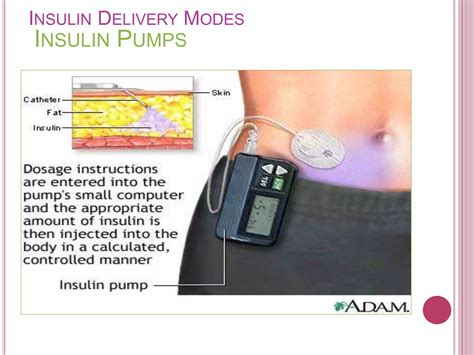 Hybrid Closed Loop Insulin Delivery System Artificial Pancreas Pptx