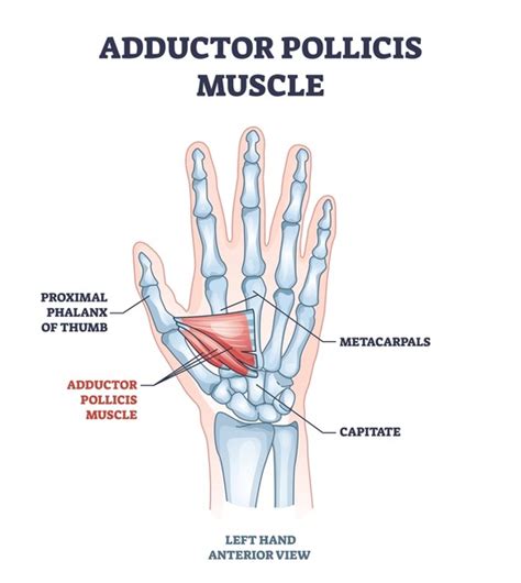 Adductor Pollicis Atrophy