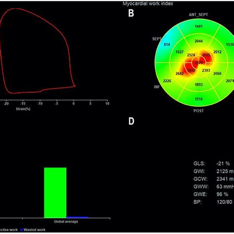 Measurement Of Myocardial Work Indices By 2d Echocardiography A Left