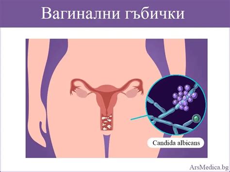 Висока пикочна киселина причини Arsmedica Bg