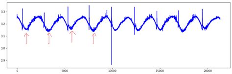 Periodic How To Detect The End Of A Period Of A Repeating Pattern In