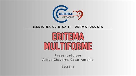 Eritema Multiforme César Antonio Aliaga Chávarry cultura medicina uDocz Eritema Multiforme César Antonio Aliaga Chávarry cultura medicina uDocz