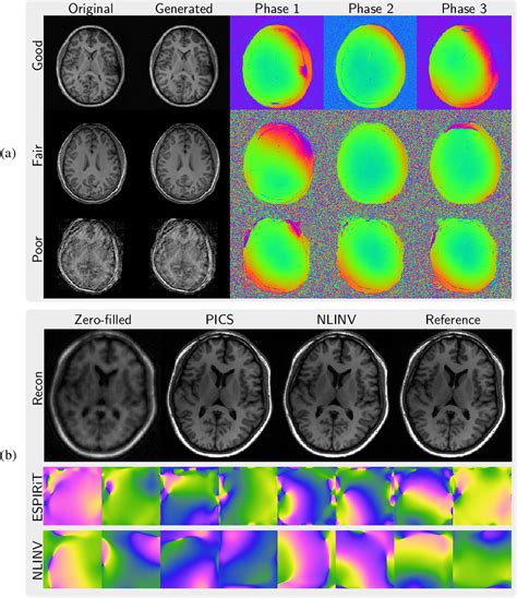 Figure 2 From Generative Image Priors For Mri Reconstruction Trained From Magnitude Only Images