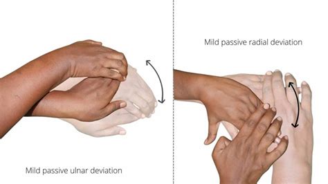 9 Effective Wrist Fracture Rehabilitation Exercises To Regain Mobility Fast