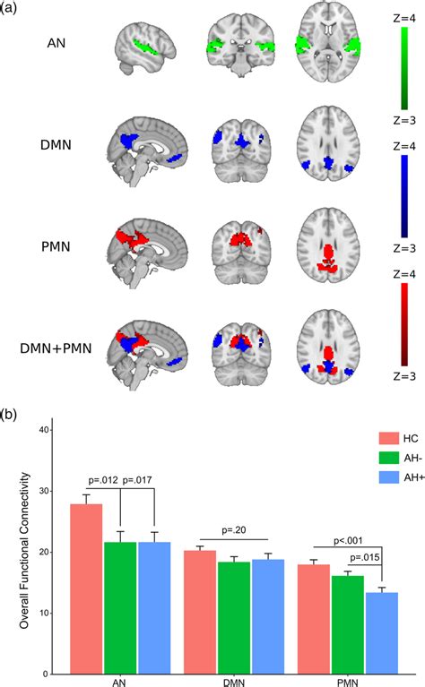 A The Group‐level Component Maps Representing Auditory Network An