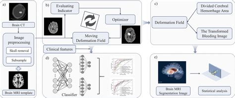 deepsap a novel brain image based deep learning model for predicting