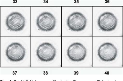 Figure 4 From Fast Autofocus Algorithm For Automated Microscopes