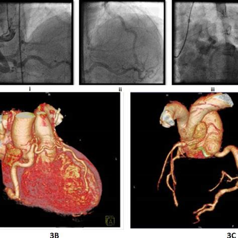A −m Mode Of Lv Showing Moderate Lv Systolic Dysfunction Ef 40 B −