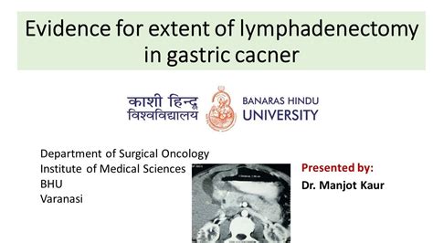 Evidence For Extent Of Optimal Lymphadenectomy In Gastric Cancer Youtube