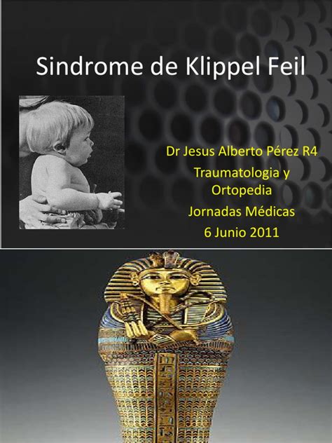 Síndrome De Klippel Feil Diagnóstico Y Tratamiento Pdf
