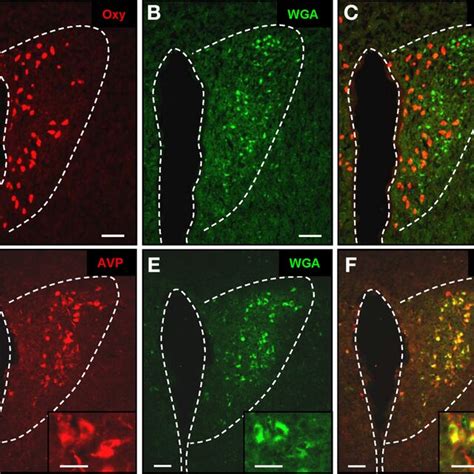 Dii Labeled Fibers In The Supraoptic Nucleus Of The Hypothalamus A
