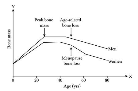 A Predict Bone Density In Males Vs Females With Age Yrs On The X Axis B Why Do Women Lose