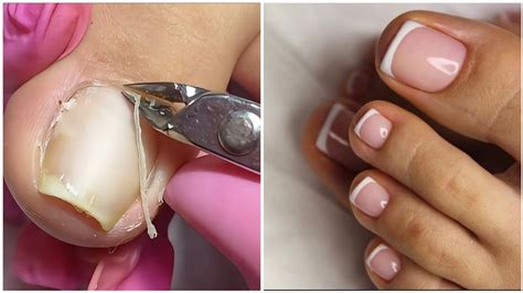 Most Satisfying Asmr Pedicure Transformation Youtube