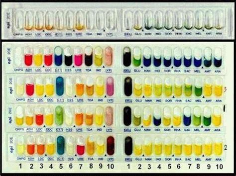 Api 20e Performing An Api 20e Strip Test By Abdelrazeks Microbiology