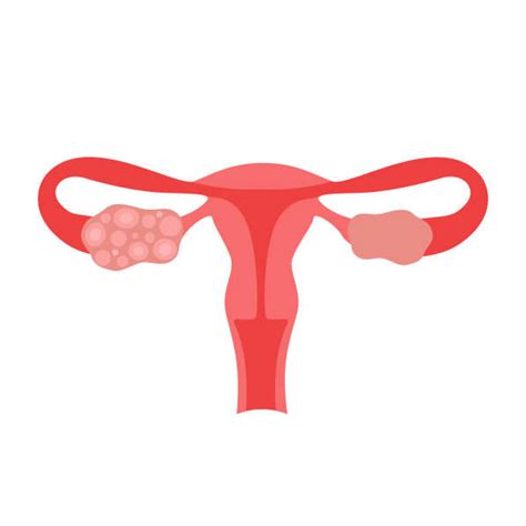 High Quality Precise Grams Stain Vaginal Swab Near Me Lucid