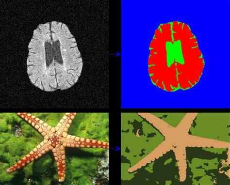 Image Segmentaion By Fcmp Download Scientific Diagram