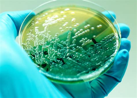 Identification Rapide Des Bactéries Pathogènes Grâce à La Spectroscopie