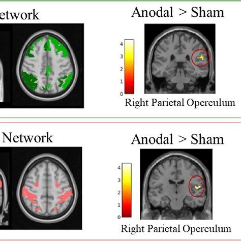 Identified Frontoparietal Network A And Dorsal Attention Network B Download Scientific