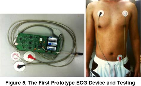 Figure 1 From Design And Implementation Of A Wearable ECG System Semantic Scholar