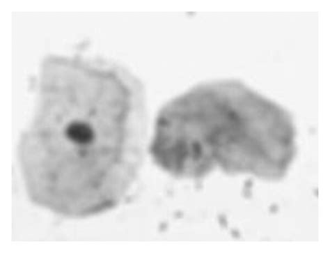 The Effect Of Gaussian Filtering A Before Filtering And B After Download Scientific