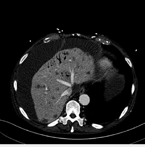Cross Sectional View Of The Same Contrast Enhanced Ct Scan Of The Download Scientific Diagram