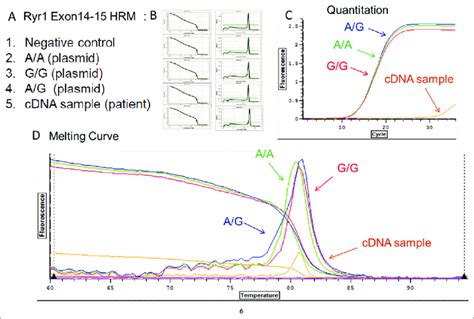 The Ability Of High Resolution Melting Analysis To Differentiate Download Scientific Diagram
